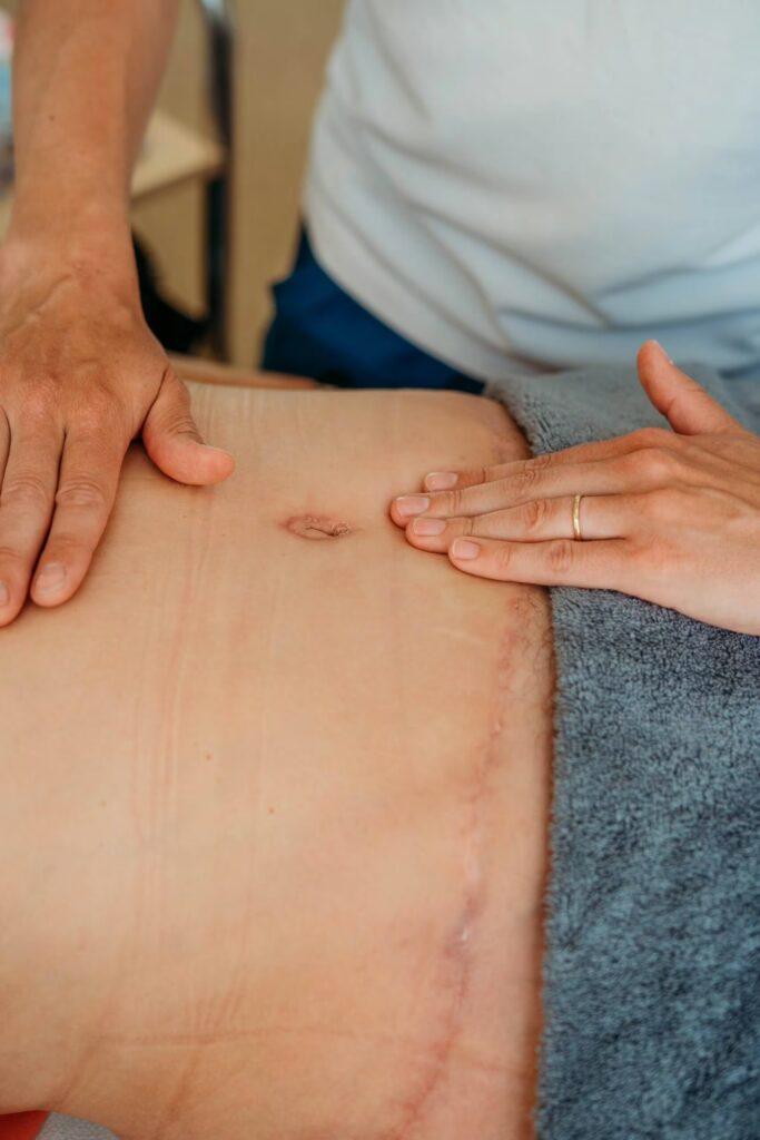 Scar Therapy - Godalming Physiotherapy